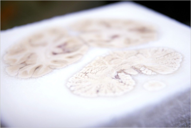 The World’s Most Famous Brain | Amusing Planet